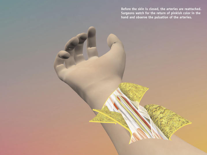 The operation – Felix Gretarsson